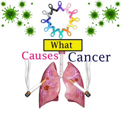 Cancer Treatment Explained: Types, Therapies, and Patient Guide – WH Type